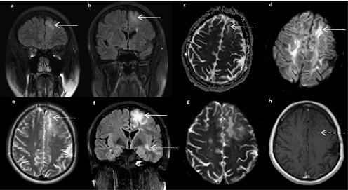 neuroradiology images 01 | Fundamentals of Neuroradiology