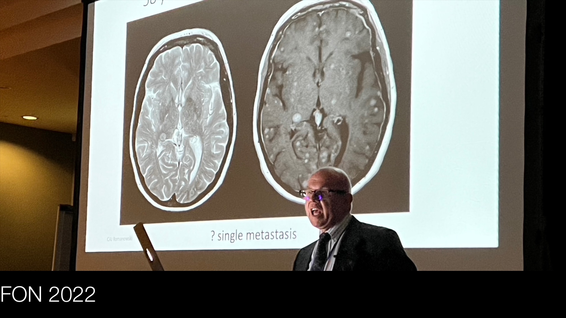 | Fundamentals of Neuroradiology